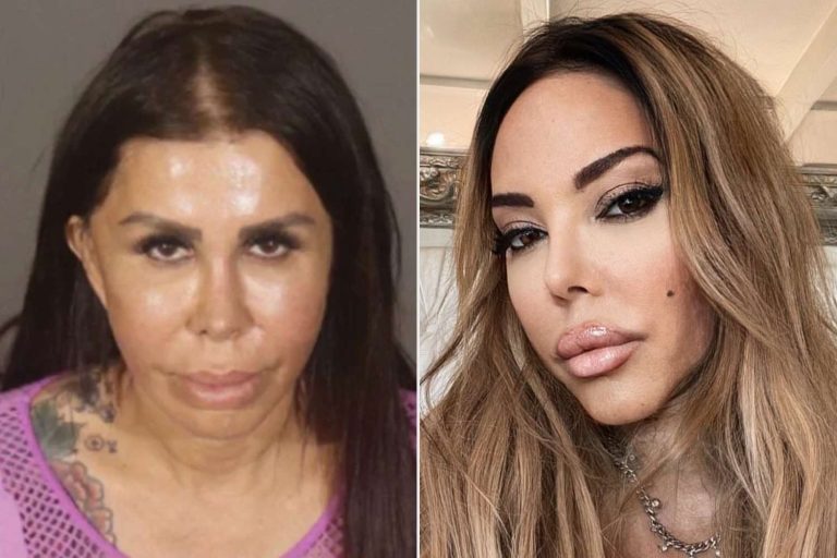 The Fatal Consequences of Illegal Cosmetic Procedures: The Tragic Case ...